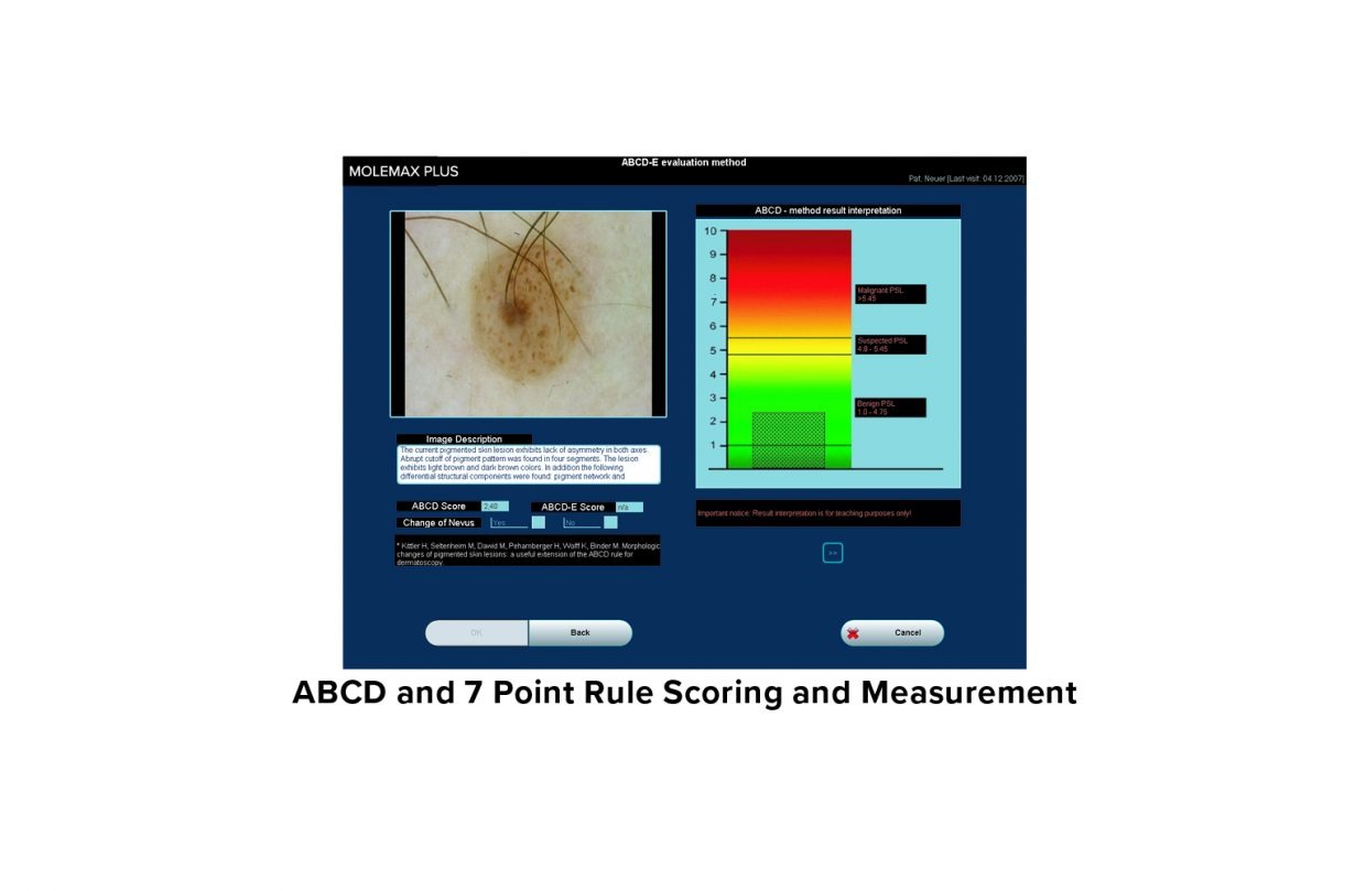 MoleMax Plus Software - MoleMax Systems